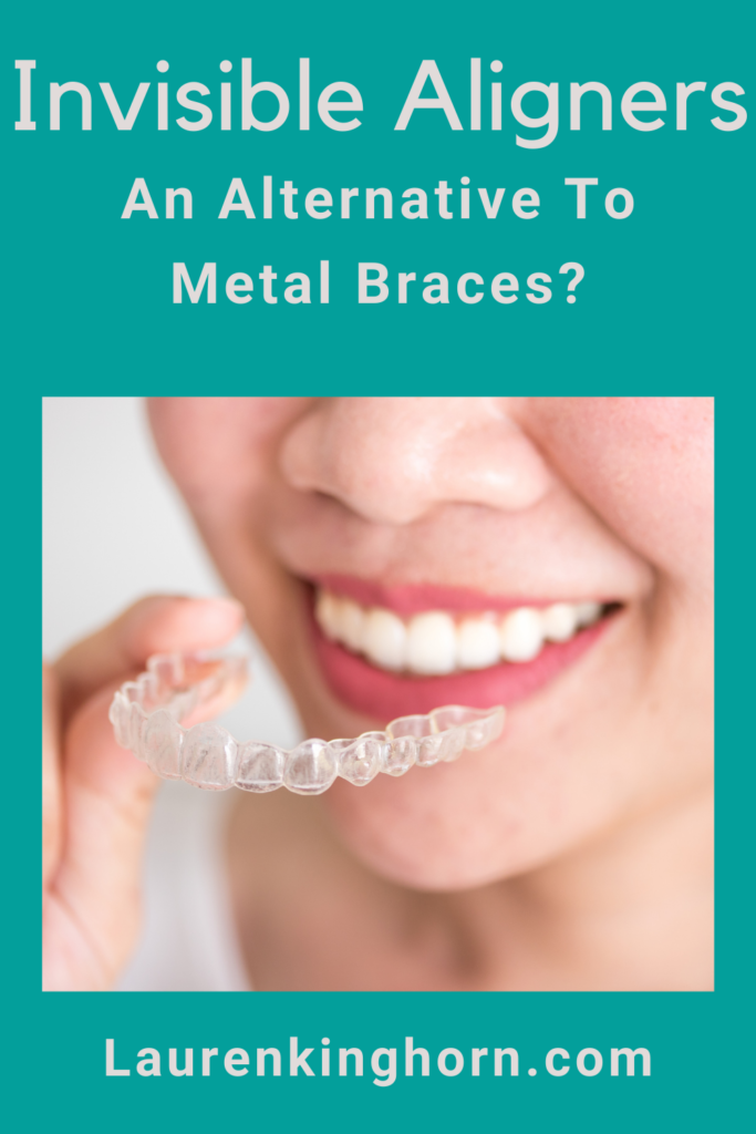 Invisible Aligners: An Alternative To Metal Braces?