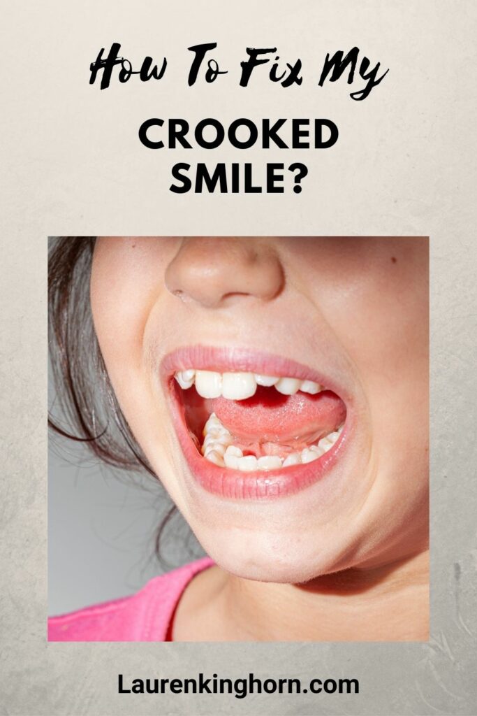 How To Fix My Crooked Smile - consider Invisalign